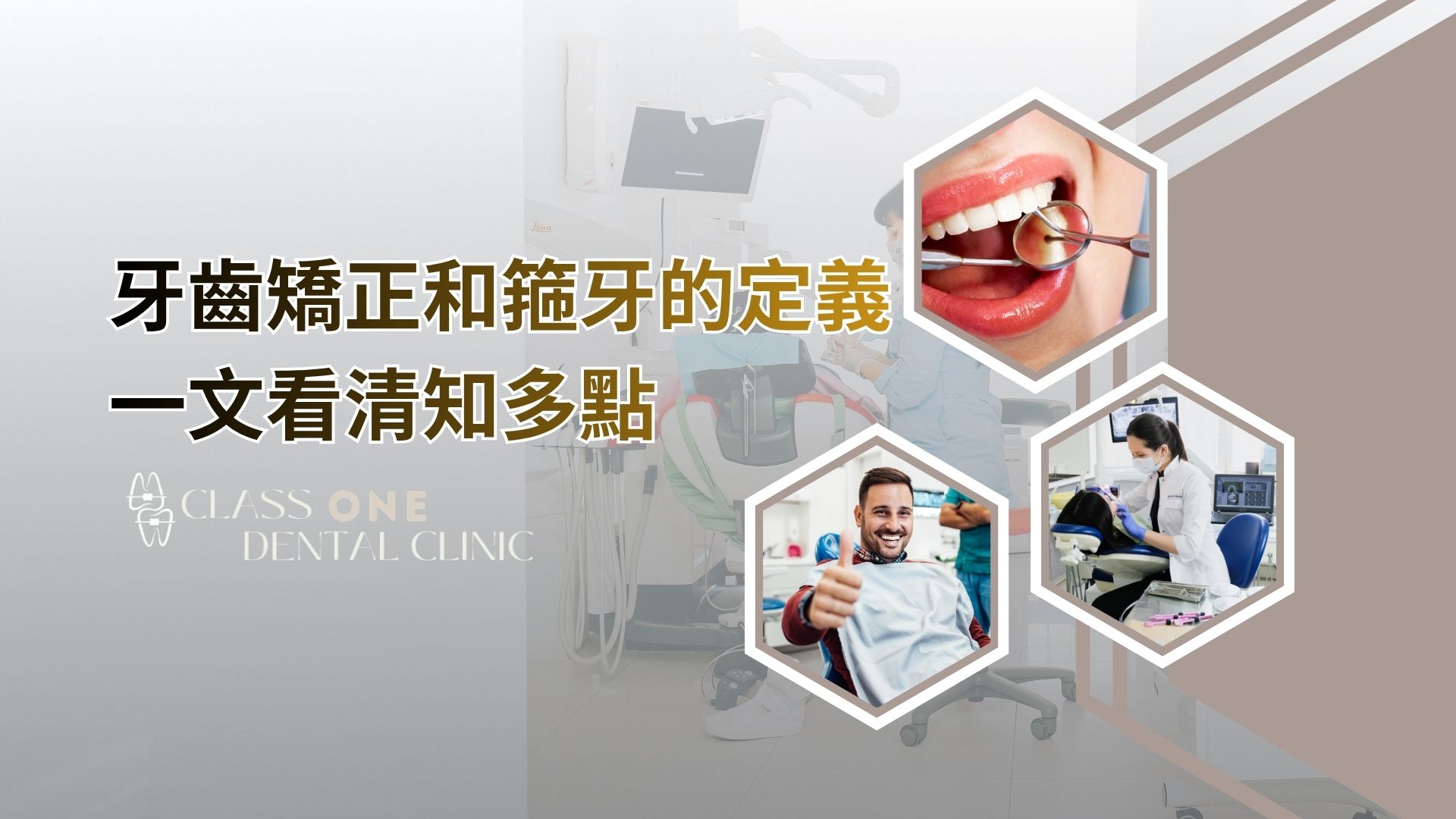 牙齒矯正和箍牙的定義，一文看清知多點 - Class ONE Dental西環堅尼地城牙醫 | 港島牙科診所