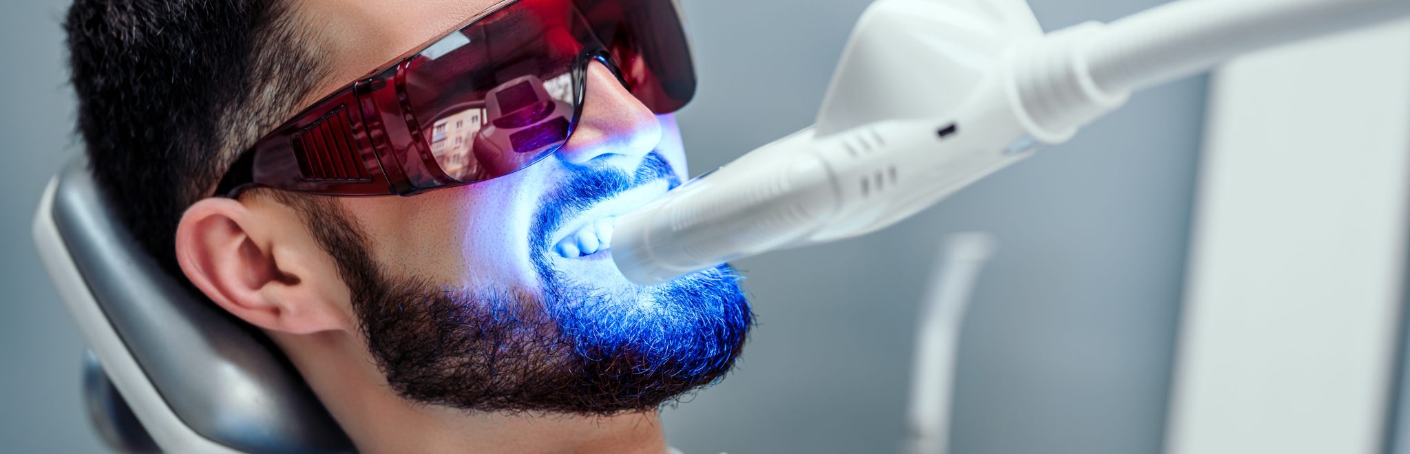 牙齒美白 - Class ONE Dental西環堅尼地城牙醫 | 港島牙科診所